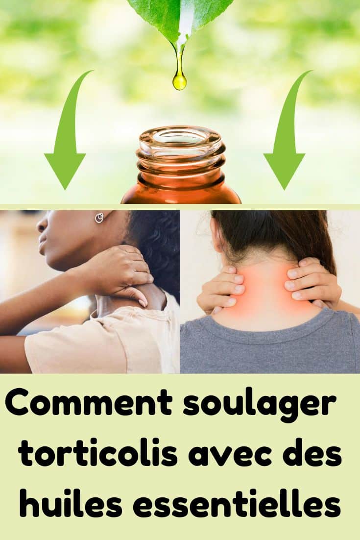 Comment soulager la douleur d'un torticolis avec des huiles ...