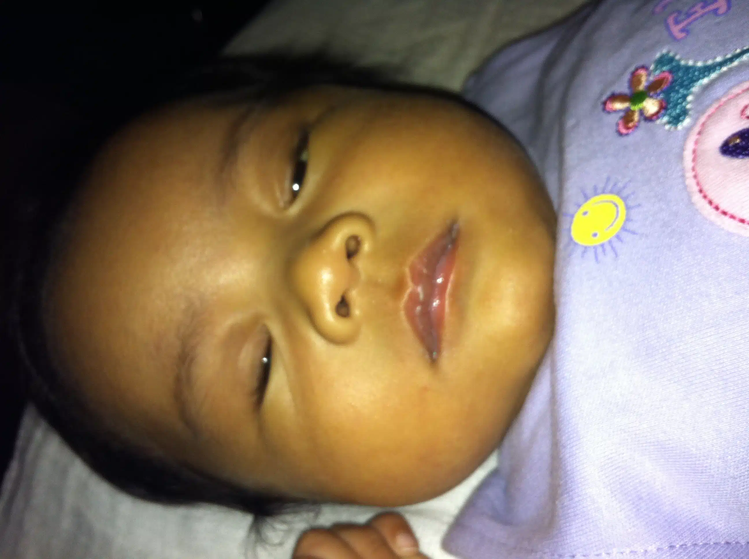 Comment traiter le "Jeti jeti" chez les bébés naturellement - Sante ...