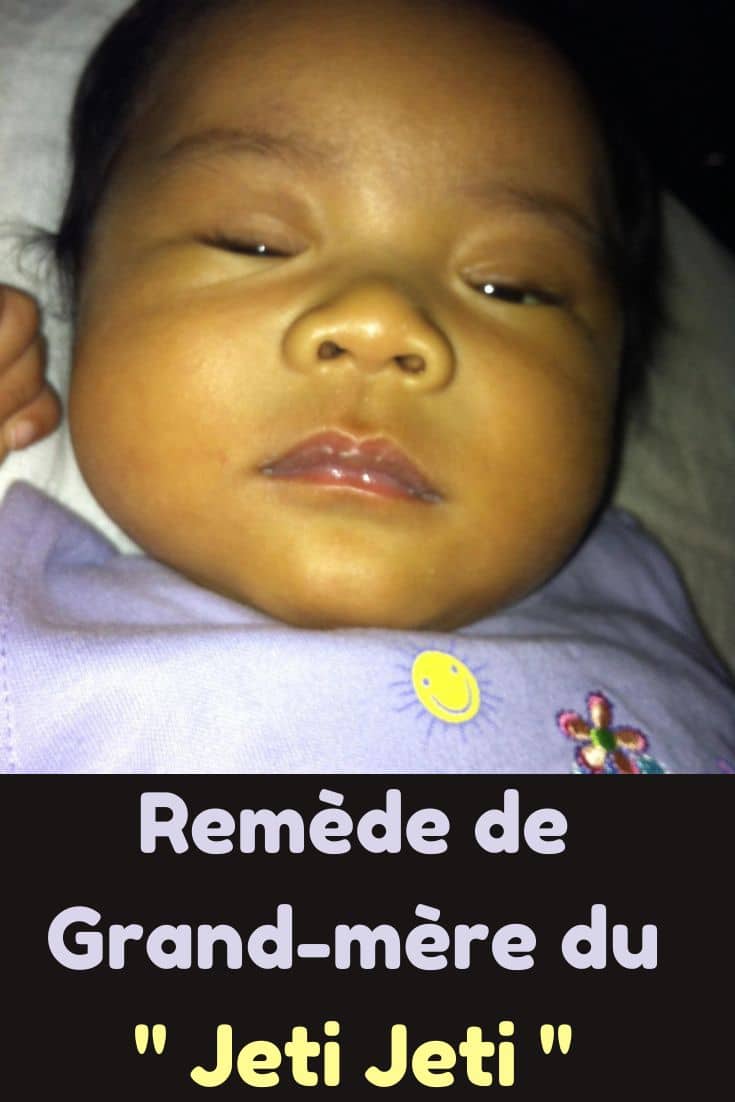 Comment traiter le "Jeti jeti" chez les bébés naturellement - Santé ...
